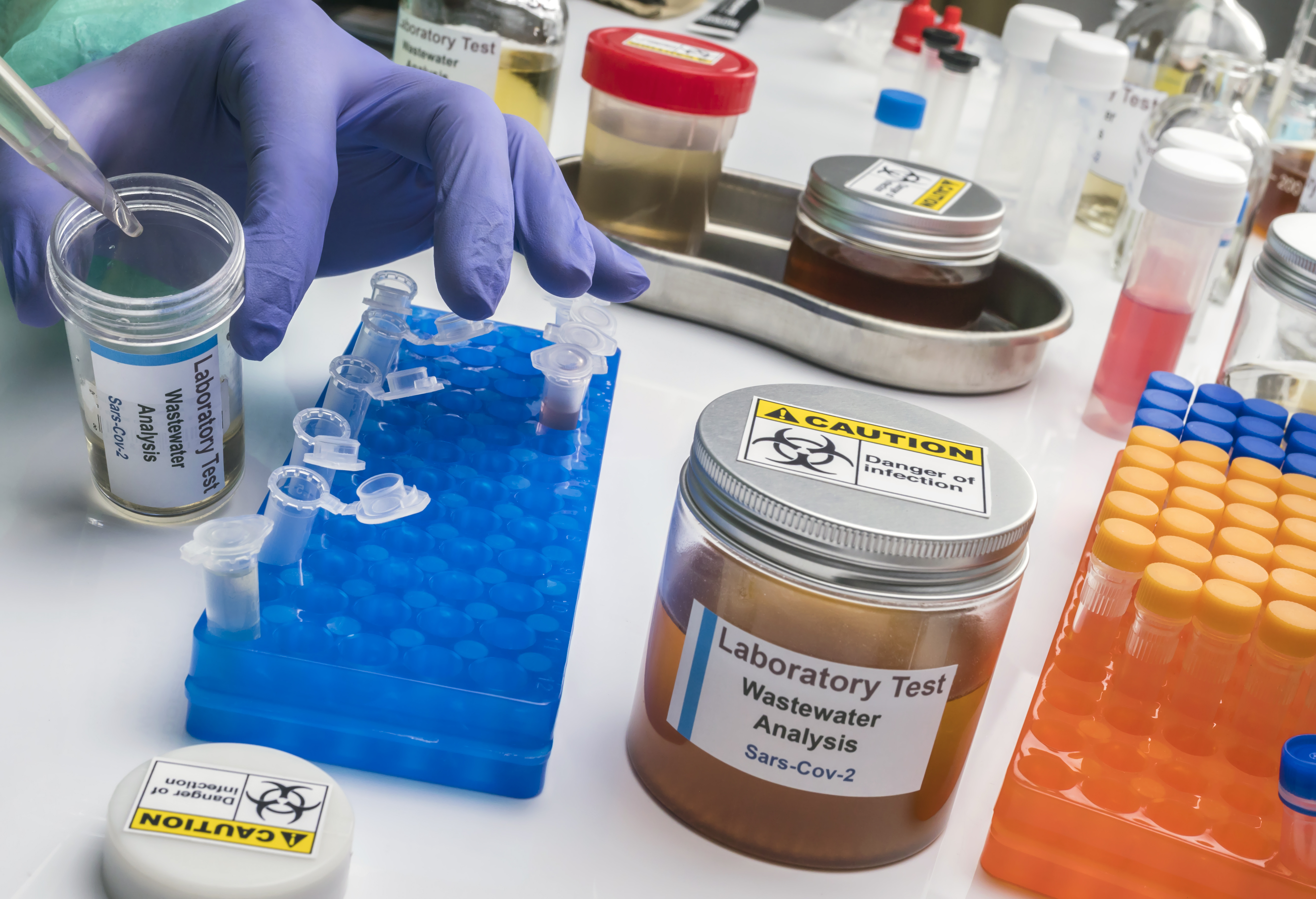 Testing Sewage for COVID-19 May Help Wastewater Workers | Pumps & Systems